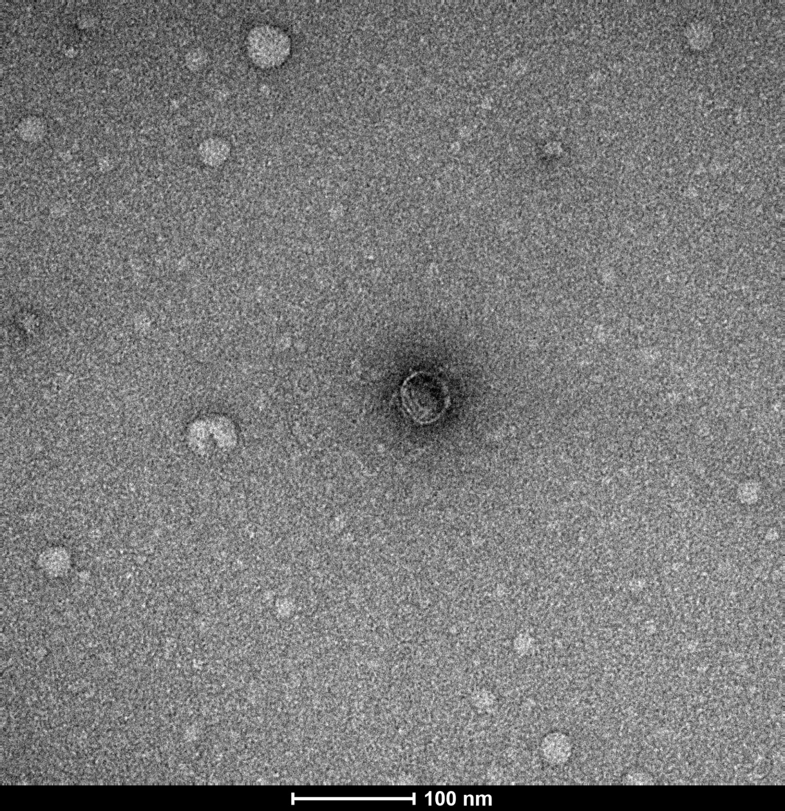 The Actinobacteriophage Database | Phage Piku